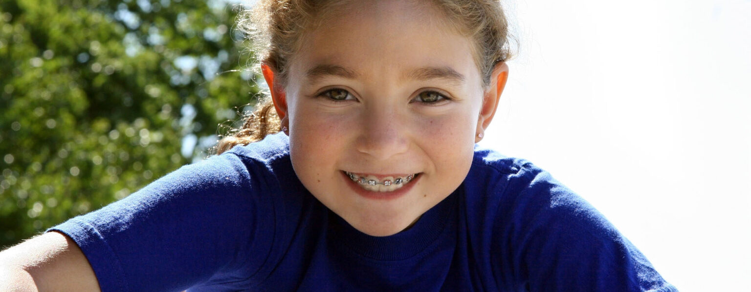 What to Do When Braces (Brackets) Fall Off | Caudill & Mcneight ...
